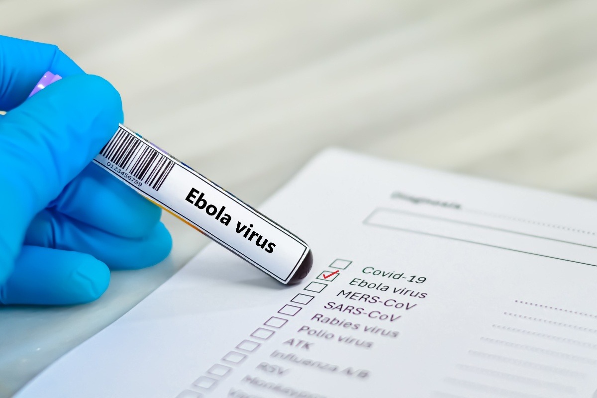 Ebola: il commento di Pregliasco sui rischi e cosa fa la differenza